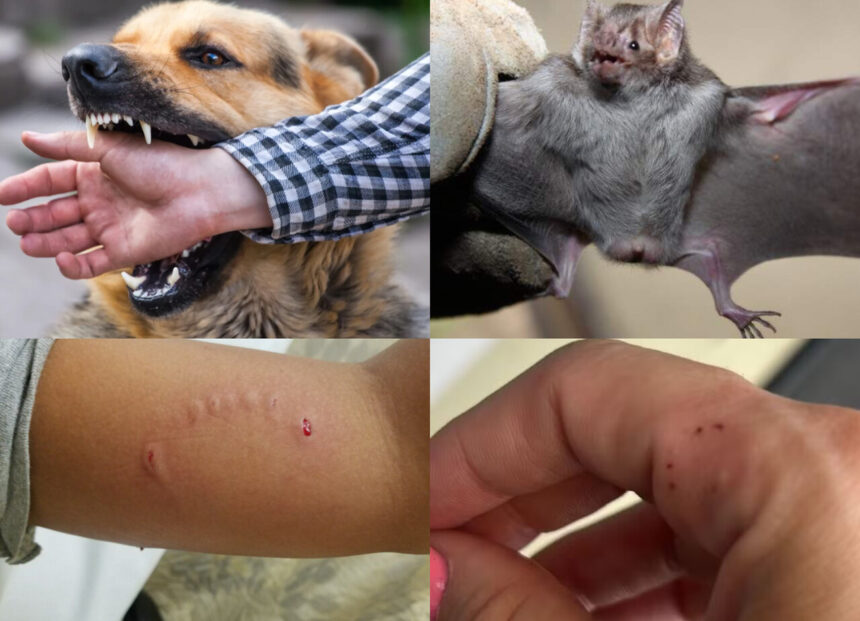 Conheça a raiva humana: sintomas, riscos e como se proteger da doença ...